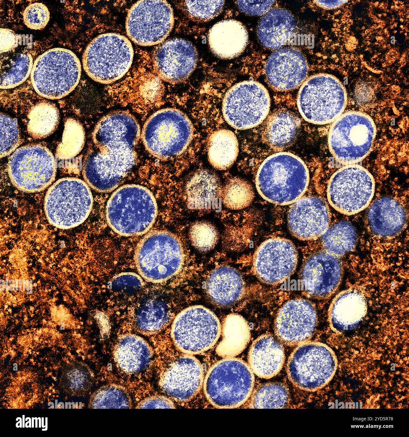 Colorized transmission electron micrograph of mpox virus particles ...