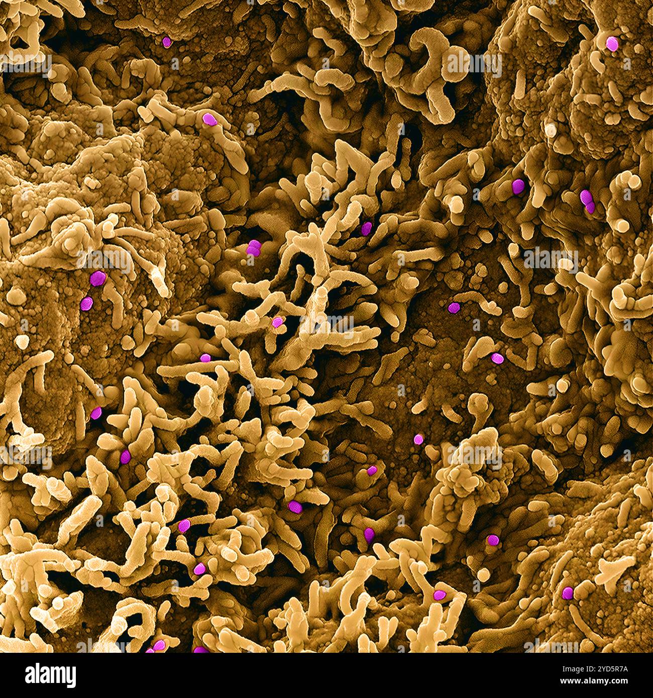 Colorized scanning electron micrograph of mpox virus (purple) on the ...