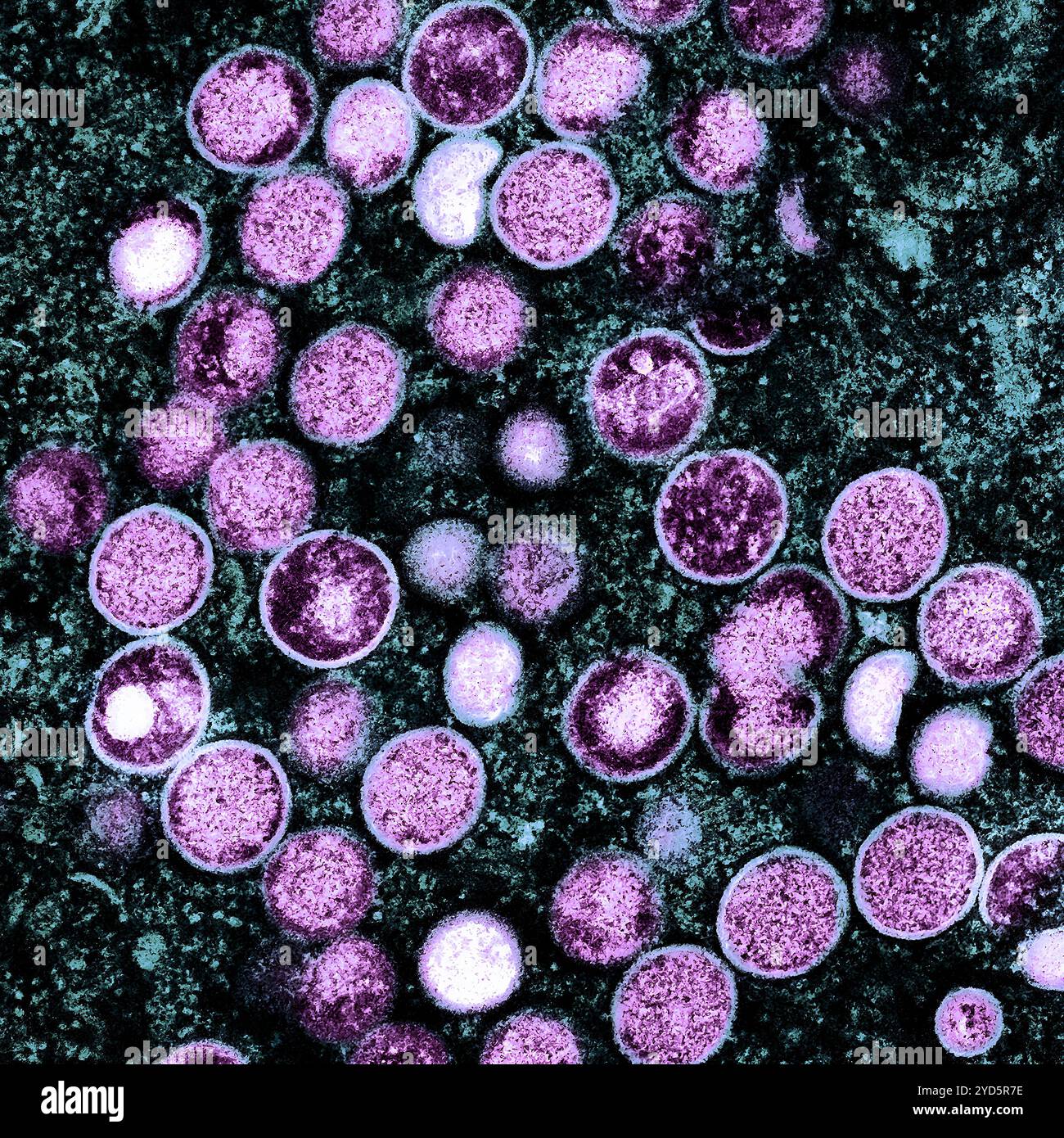 Colorized Transmission Electron Micrograph Of Mpox Virus Particles
