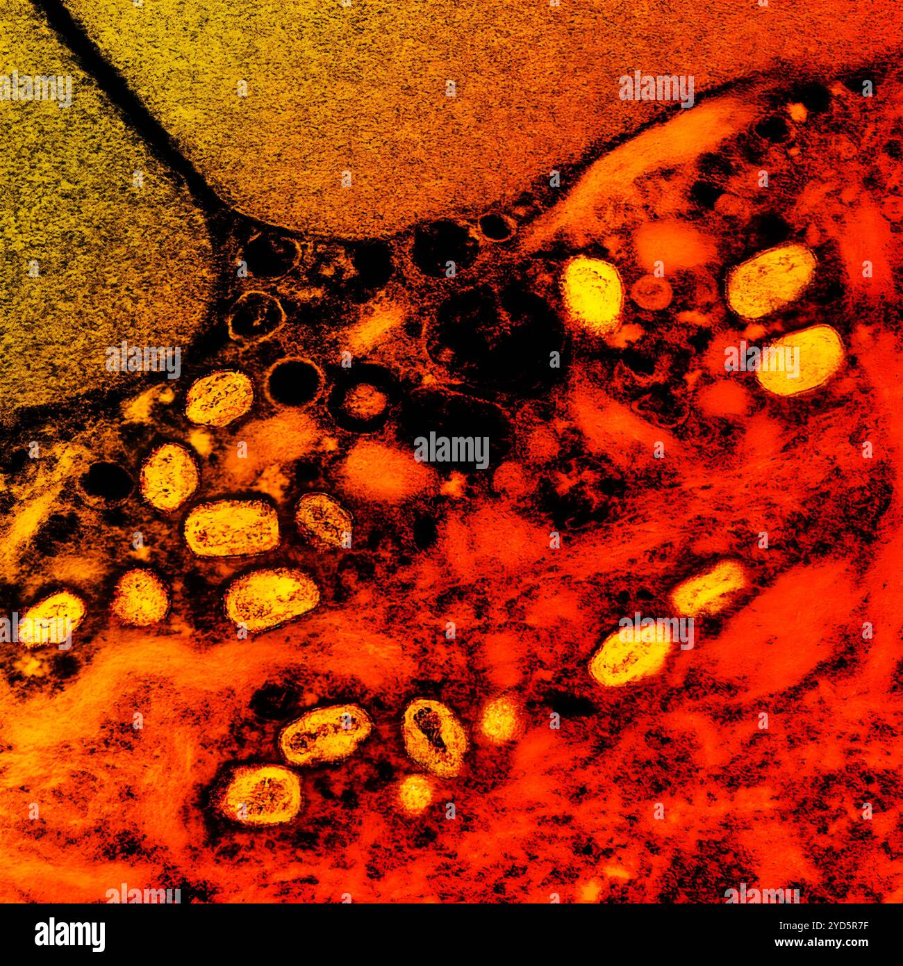 Colorized transmission electron micrograph of mpox virus particles ...