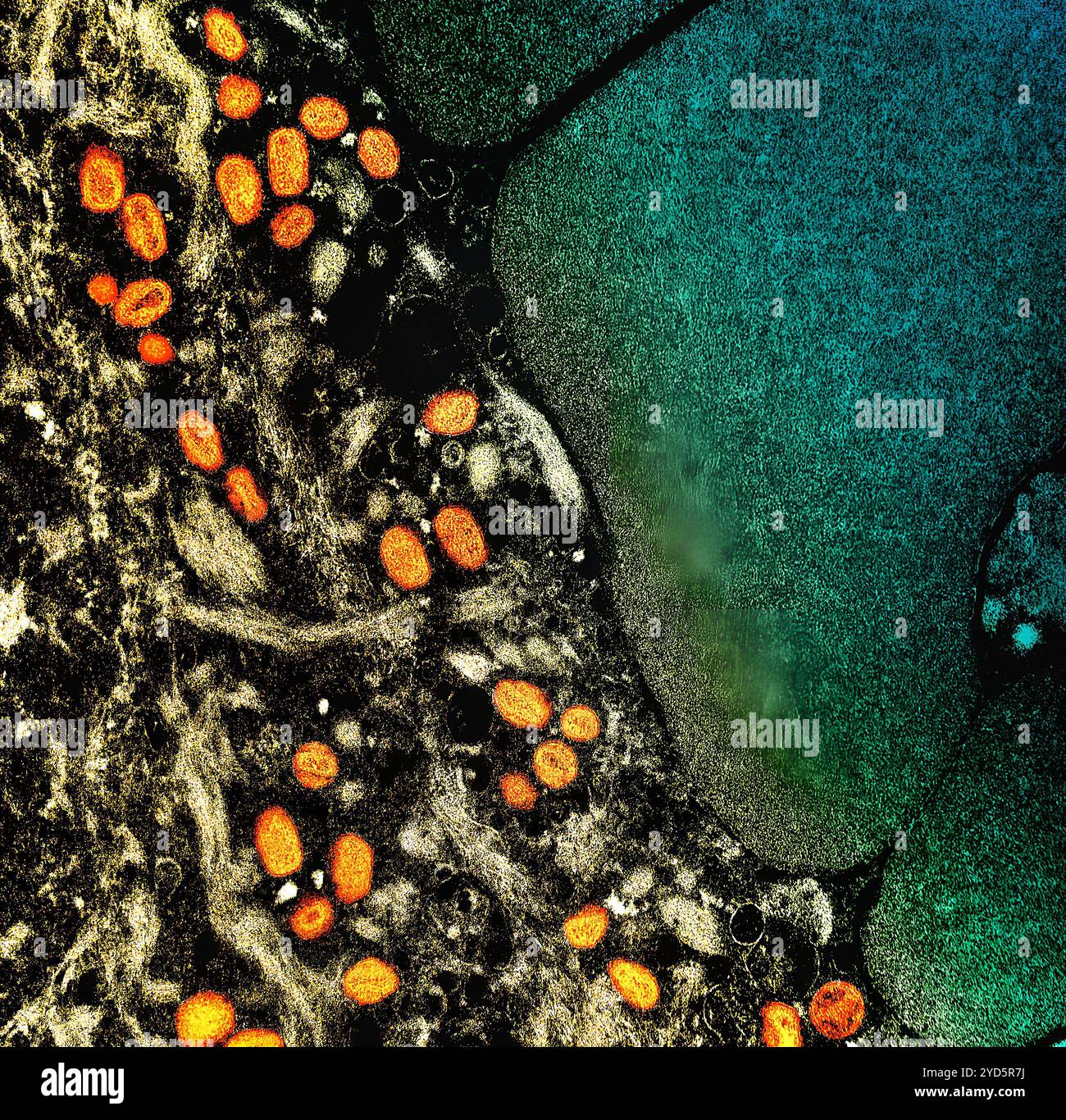 Colorized transmission electron micrograph of mpox virus particles ...