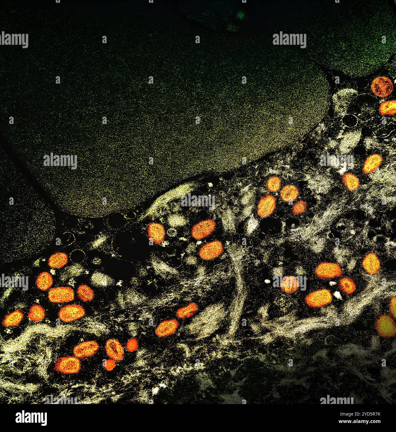 Colorized transmission electron micrograph of mpox virus particles ...