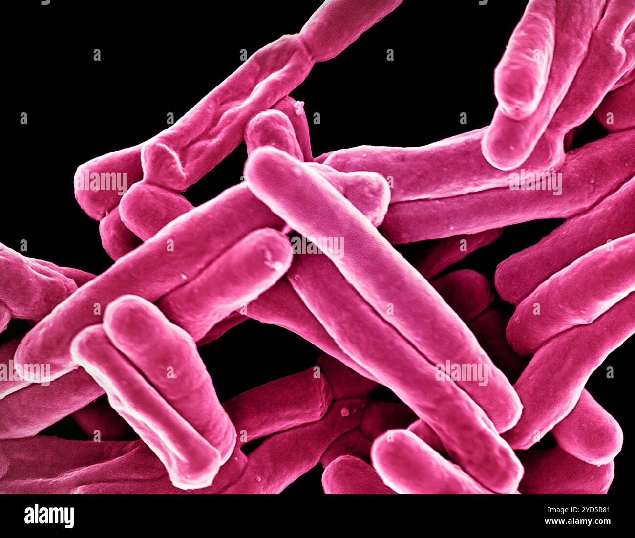 Scanning electron micrograph of Mycobacterium tuberculosis particles (colorized pink), the ...