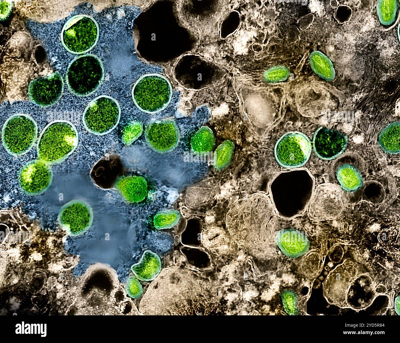 Colorized transmission electron micrograph of mpox virus particles ...