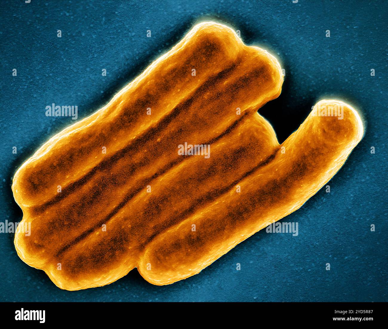 Scanning electron micrograph of Mycobacterium tuberculosis particles (colorized gold), the ...