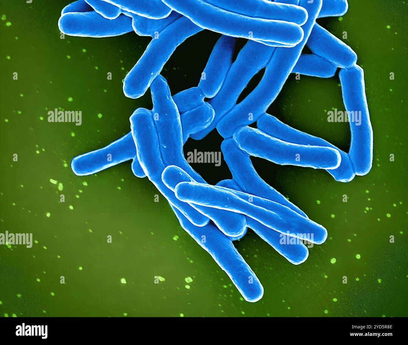 Scanning electron micrograph of Mycobacterium tuberculosis particles (colorized blue), the ...