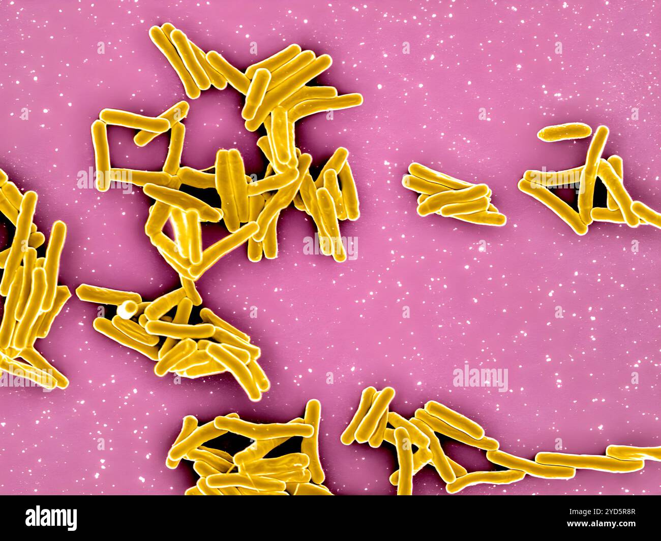 Scanning electron micrograph of Mycobacterium tuberculosis particles (colorized yellow), the ...