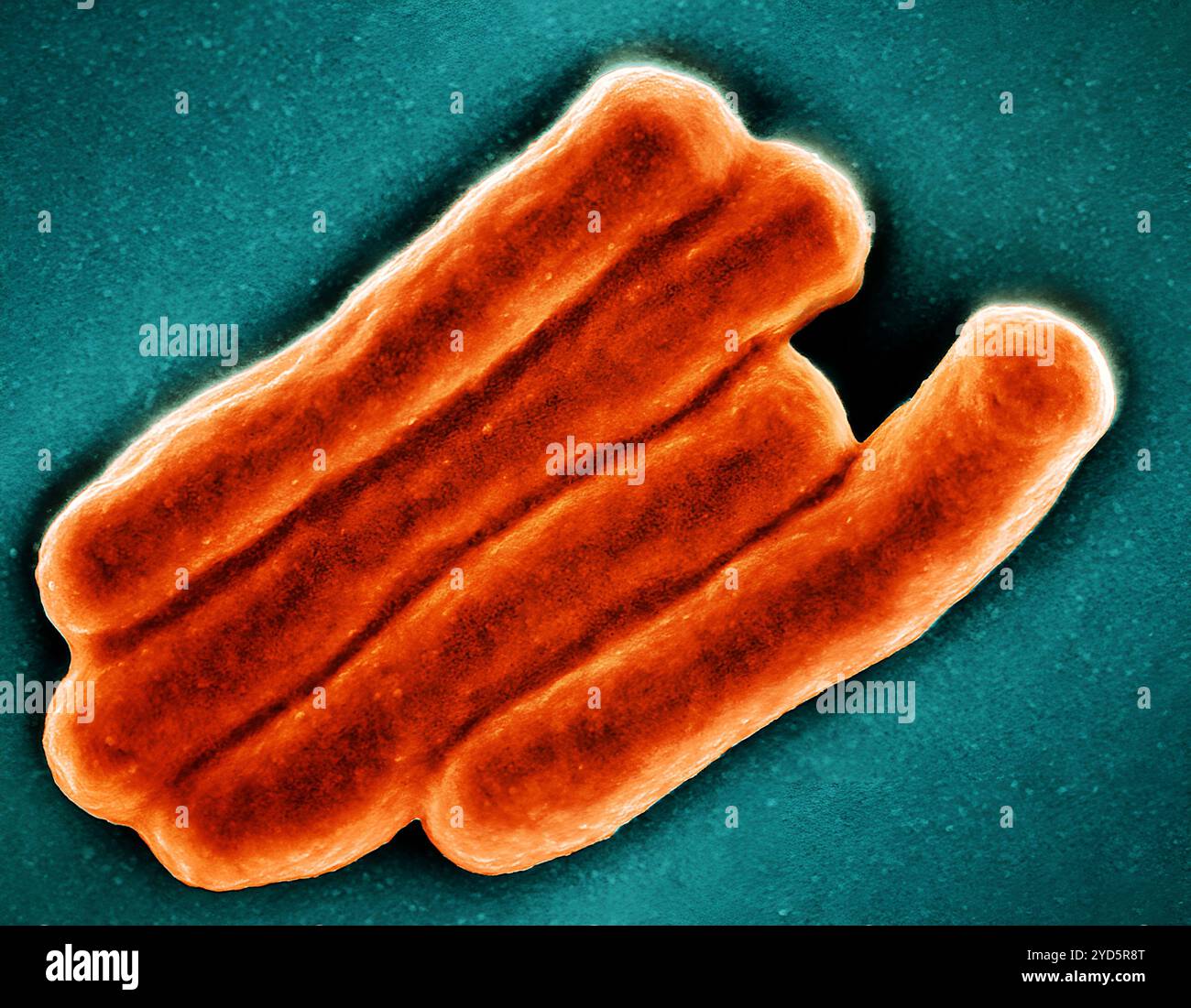Scanning electron micrograph of Mycobacterium tuberculosis particles (colorized orange), the ...