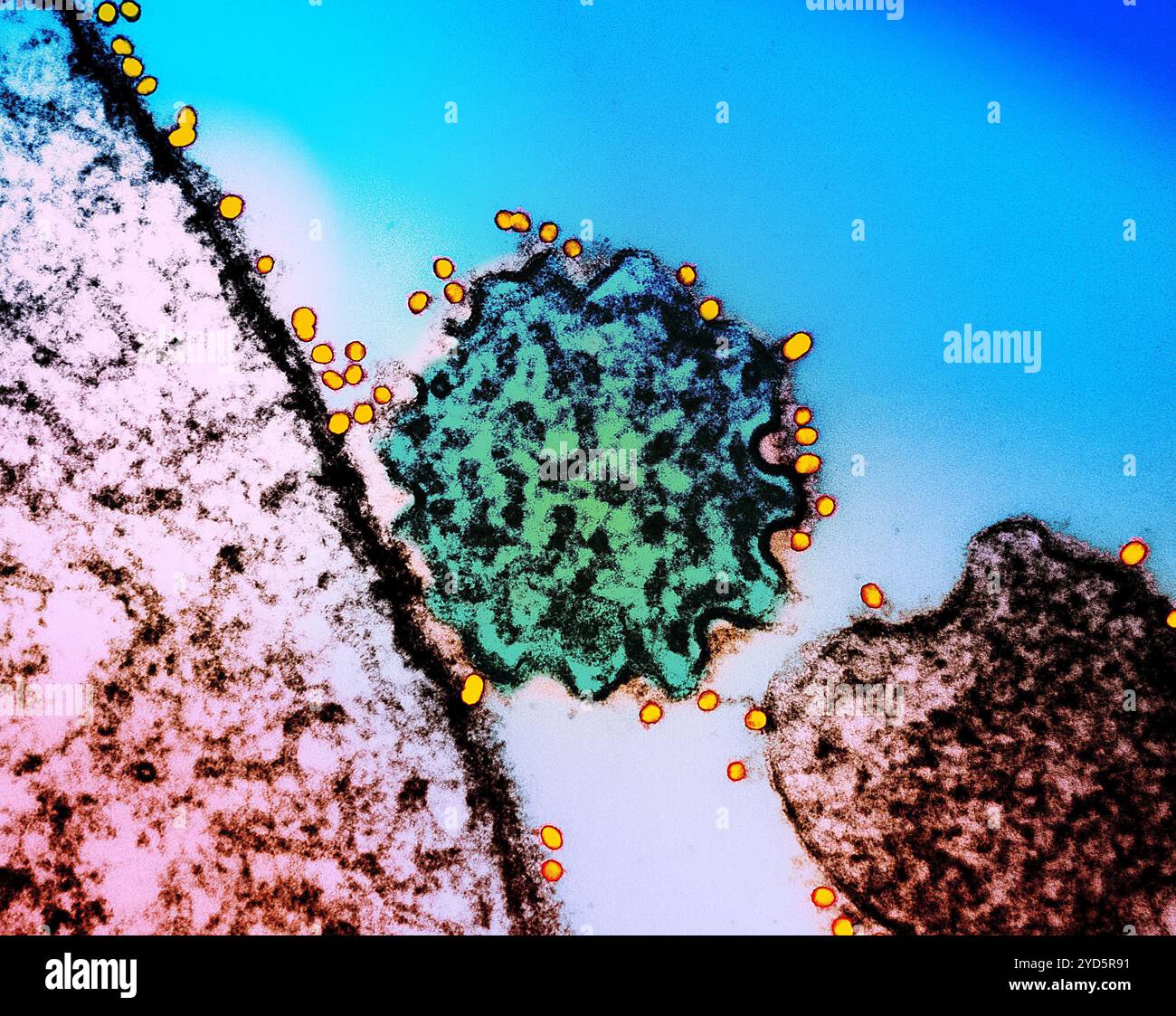 Colorized transmission electron micrograph of a single Nipah virus ...