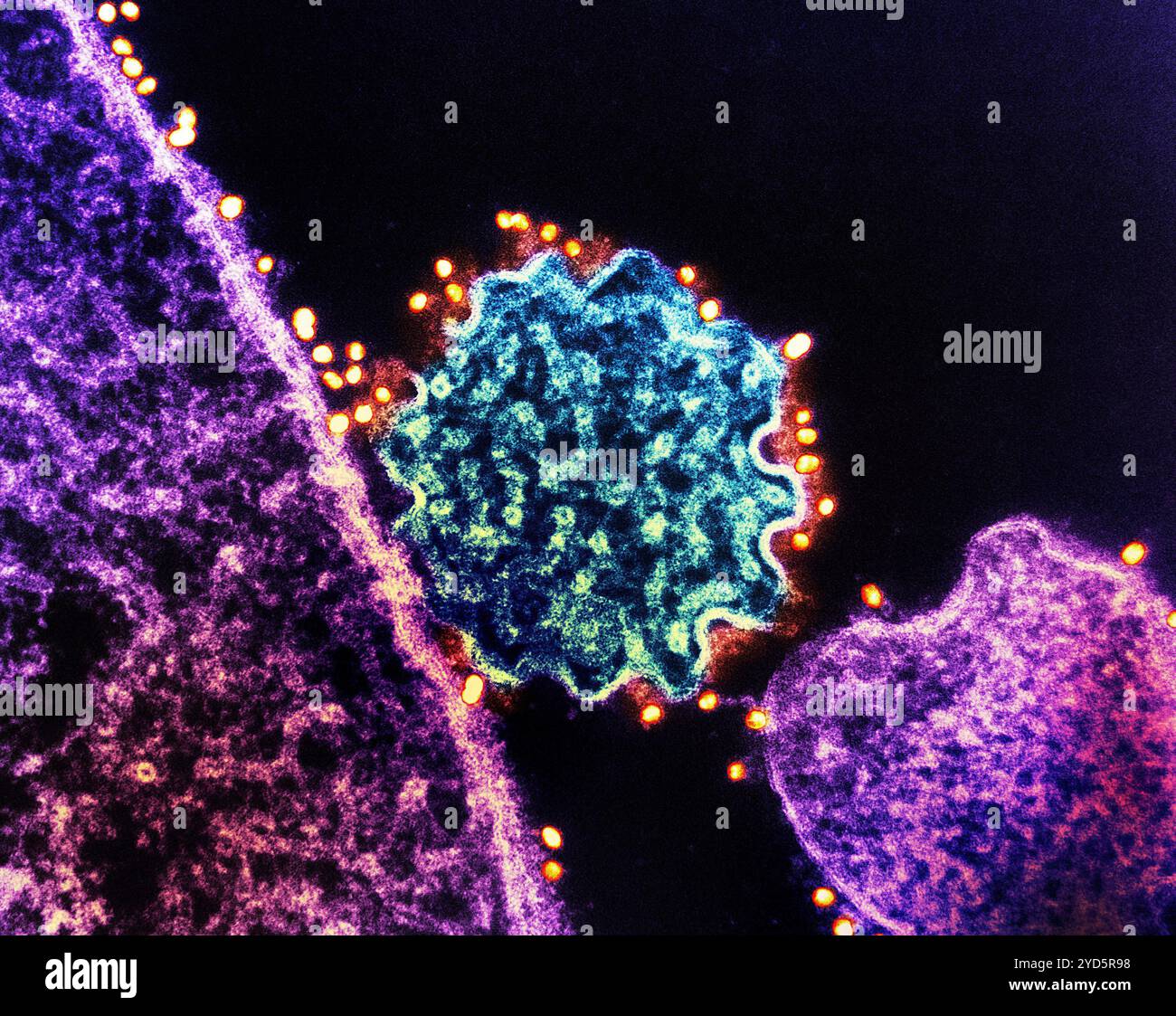 Colorized transmission electron micrograph of a single Nipah virus ...