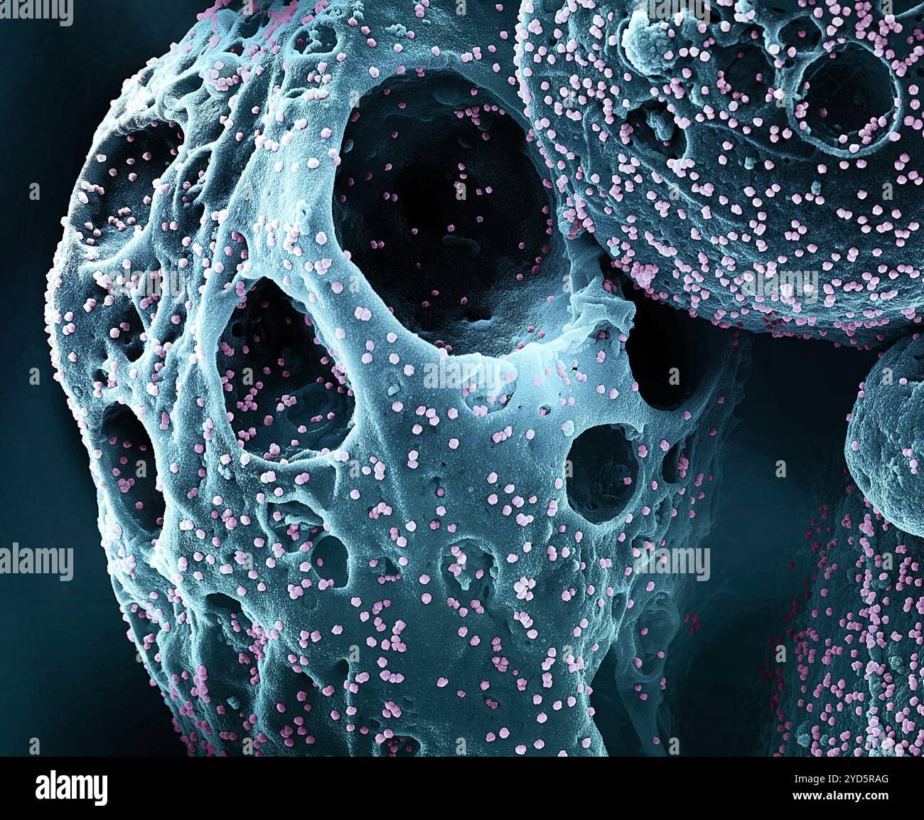 Colorized scanning electron micrograph of a cell (blue) infected with ...