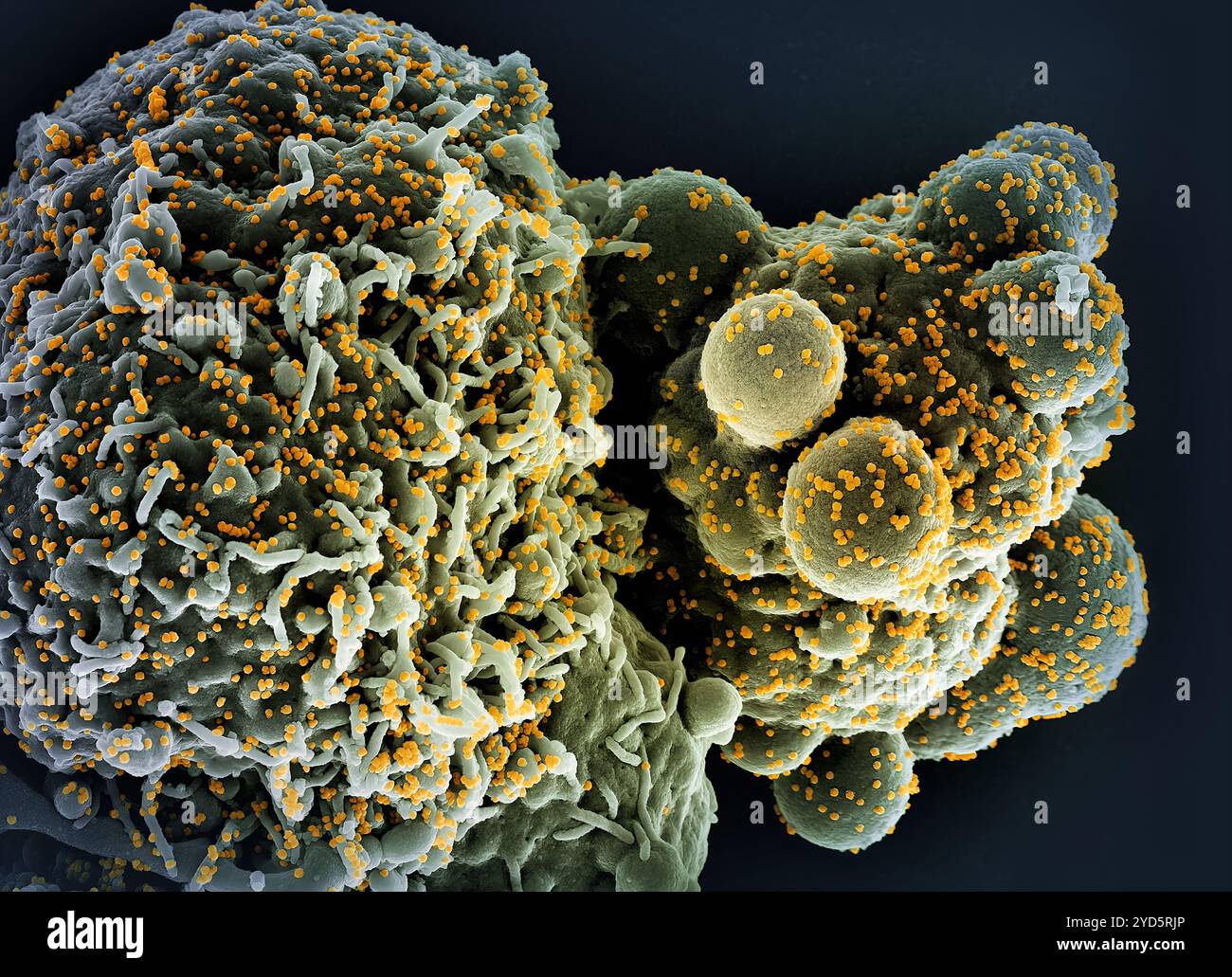 Colorized scanning electron micrograph of a cell (green) infected with ...