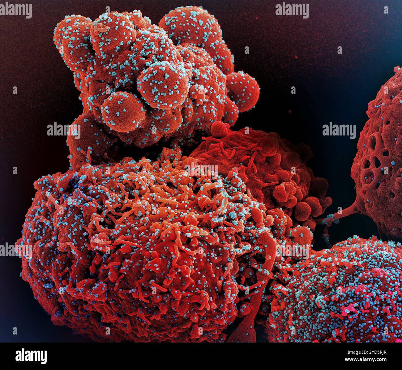 Colorized scanning electron micrograph of a cell (red) infected with ...