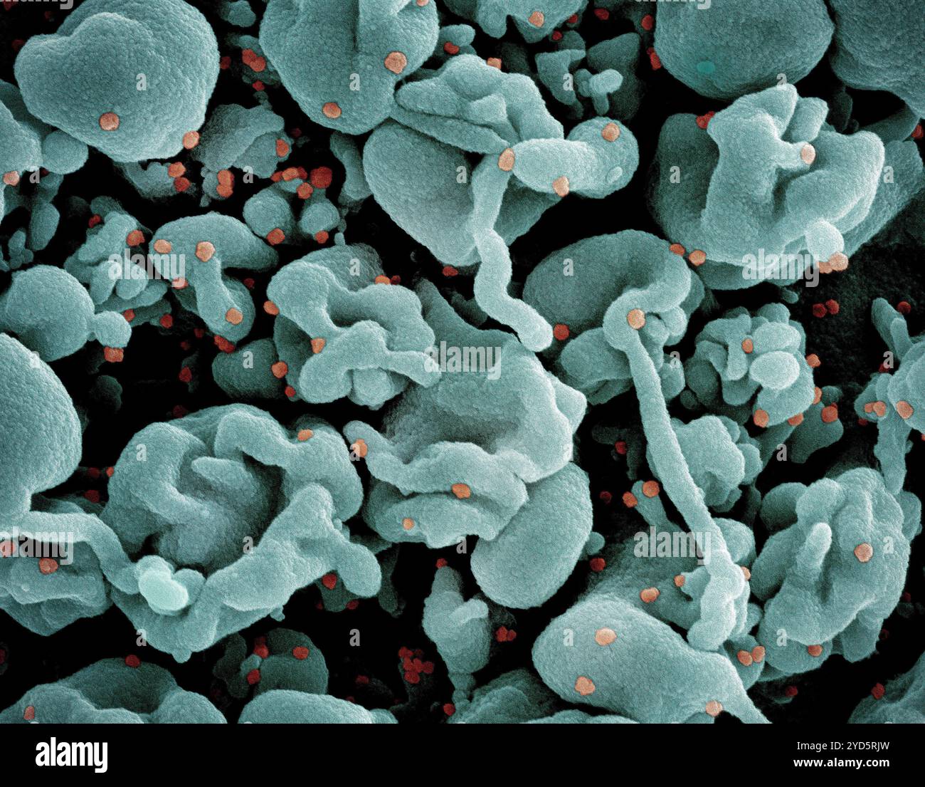 Colorized scanning electron micrograph of a cell (green) infected with ...