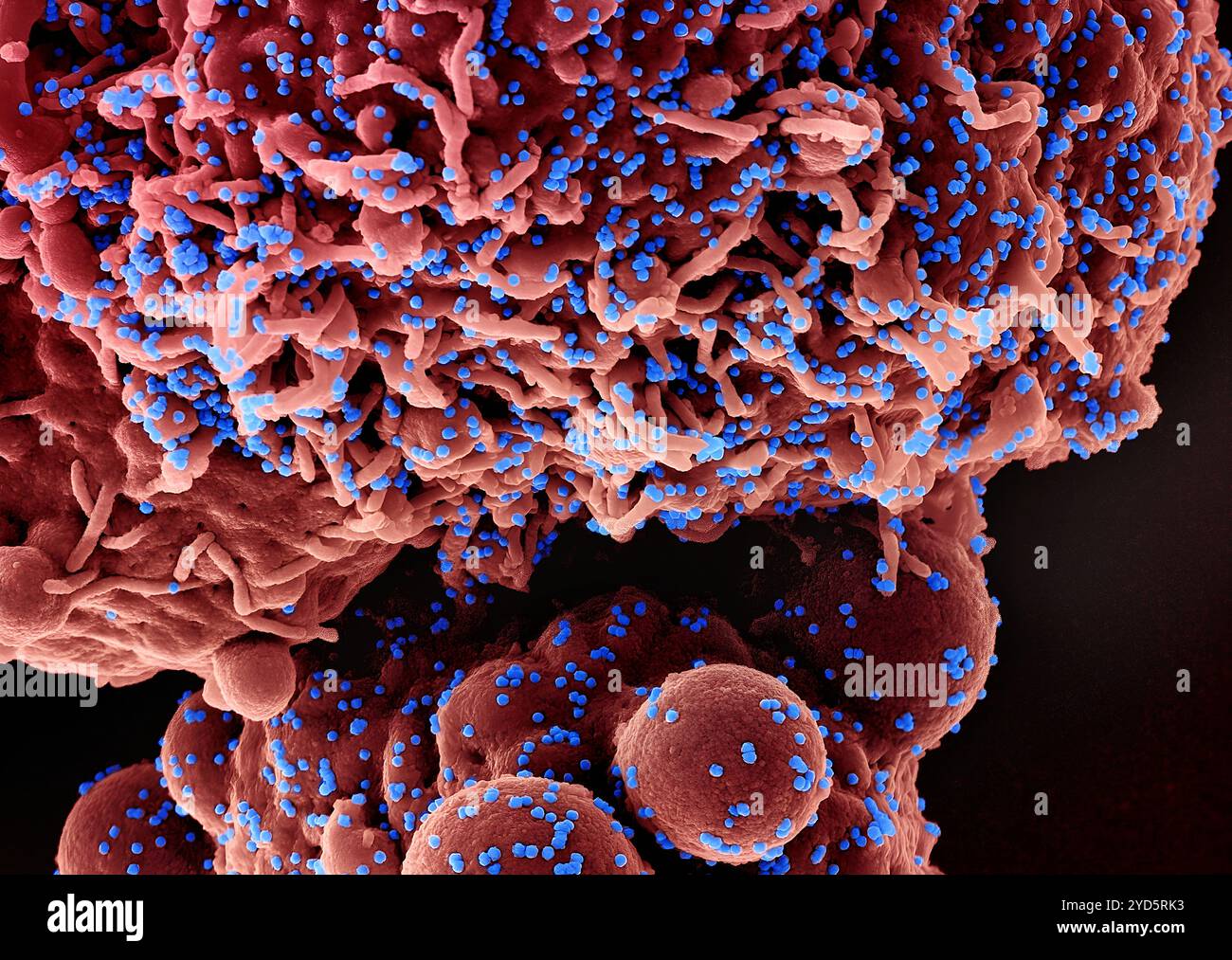 Colorized scanning electron micrograph of a cell (red) infected with ...