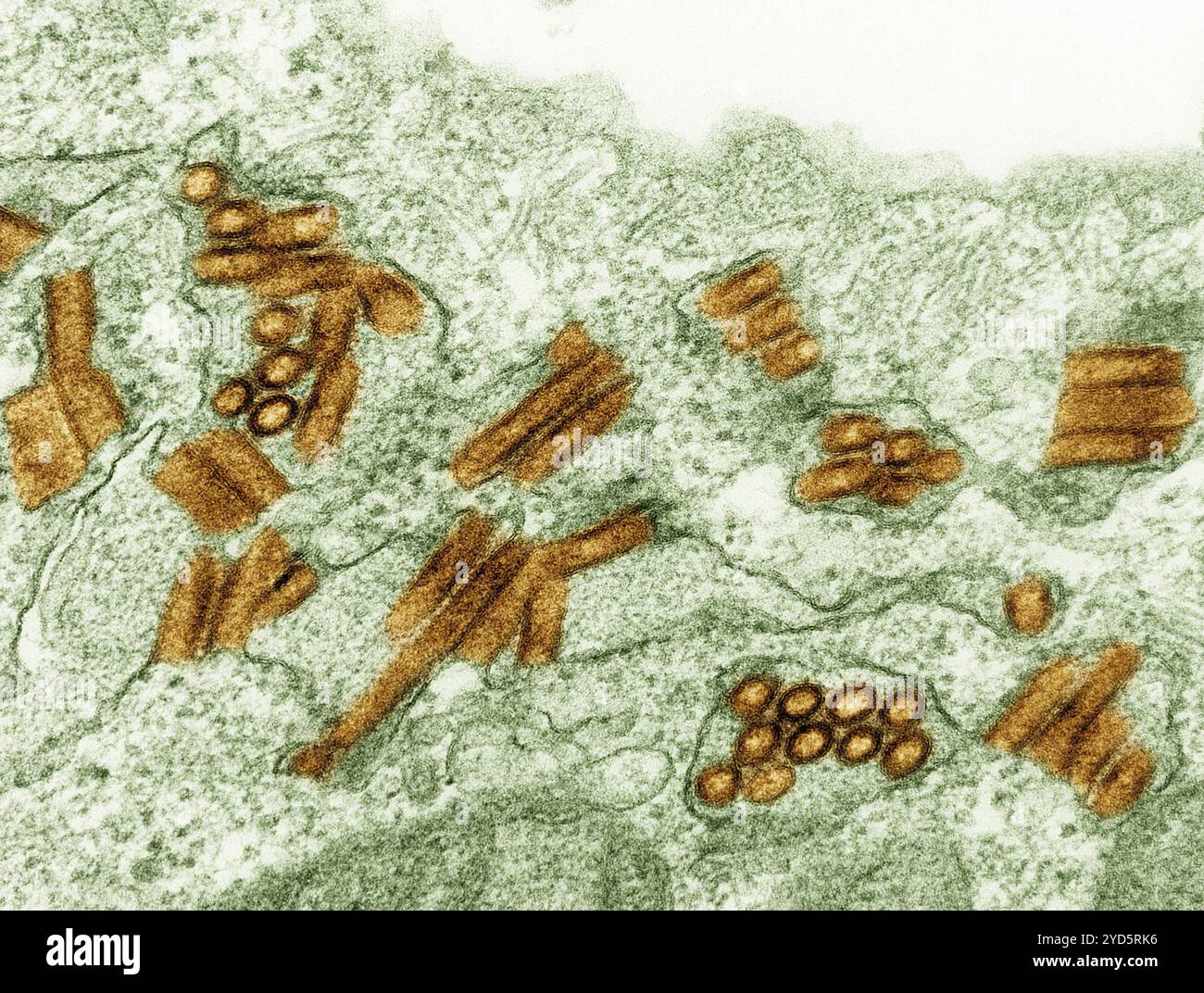Colorized transmission electron micrograph of rabies virus particles ...