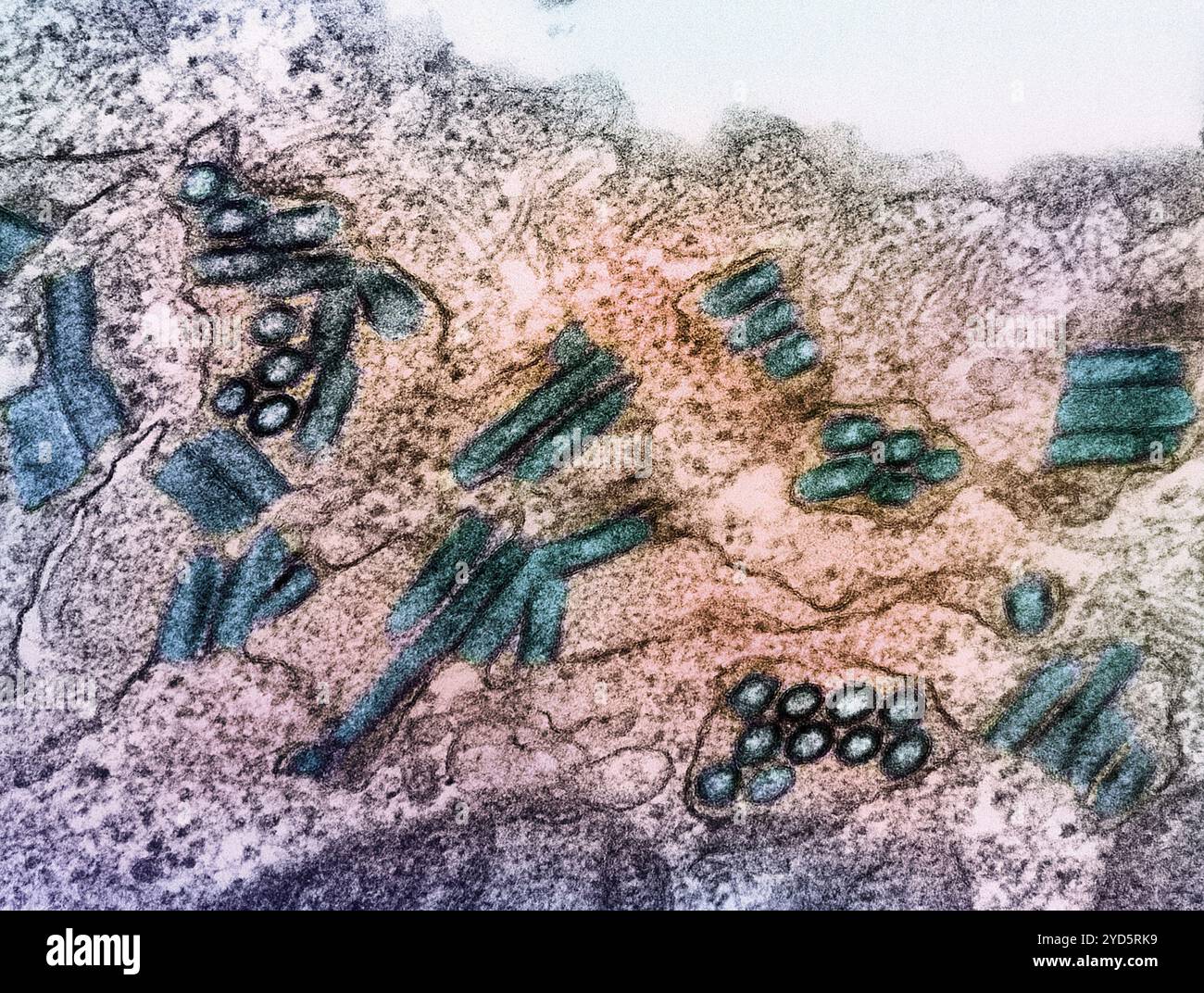 Colorized transmission electron micrograph of rabies virus particles ...