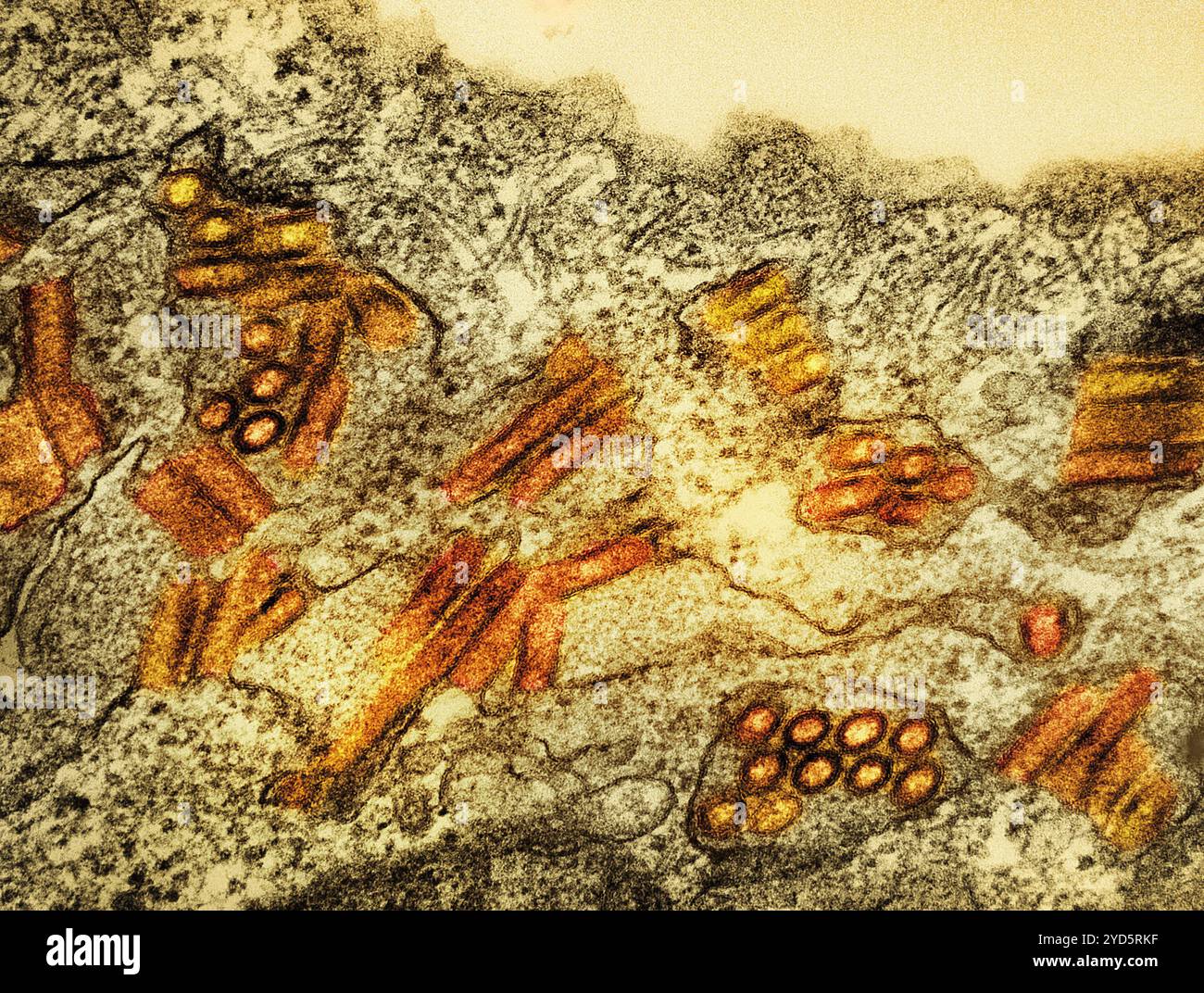 Colorized transmission electron micrograph of rabies virus particles ...