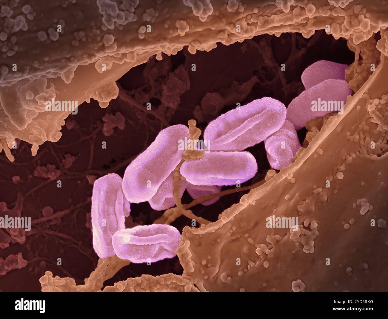 Scanning electron micrograph of Rickettsia typhi bacteria Stock Photo ...