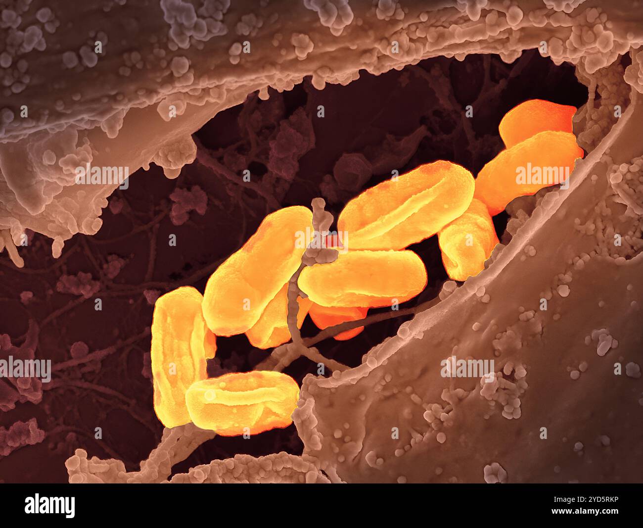 Scanning electron micrograph of Rickettsia typhi bacteria Stock Photo ...