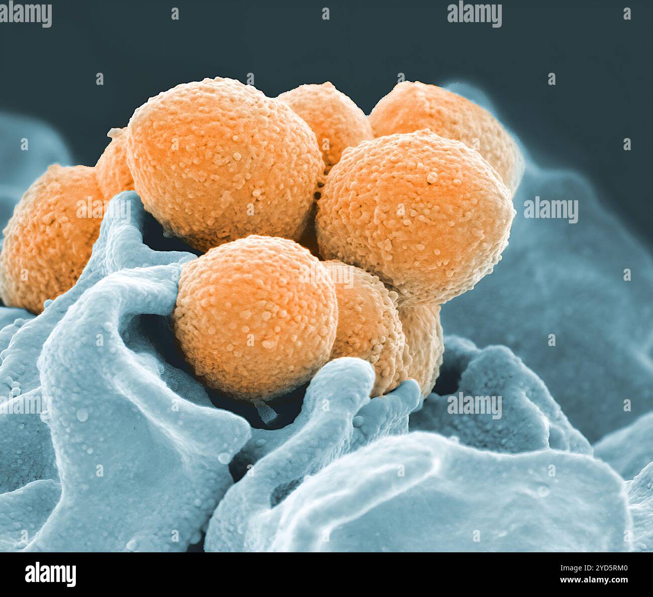 A colorized scanning electron microscope image of Group A Streptococcus ...