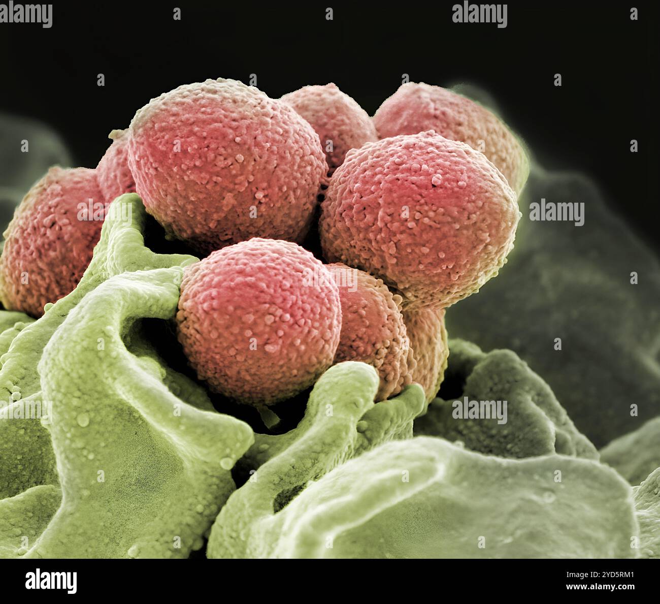 A colorized scanning electron microscope image of Group A Streptococcus ...