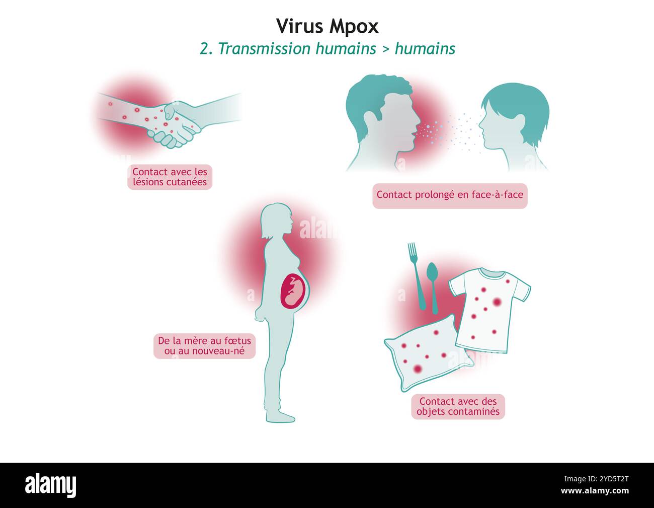 Human-to-human transmission of Mpox virus Stock Photo - Alamy