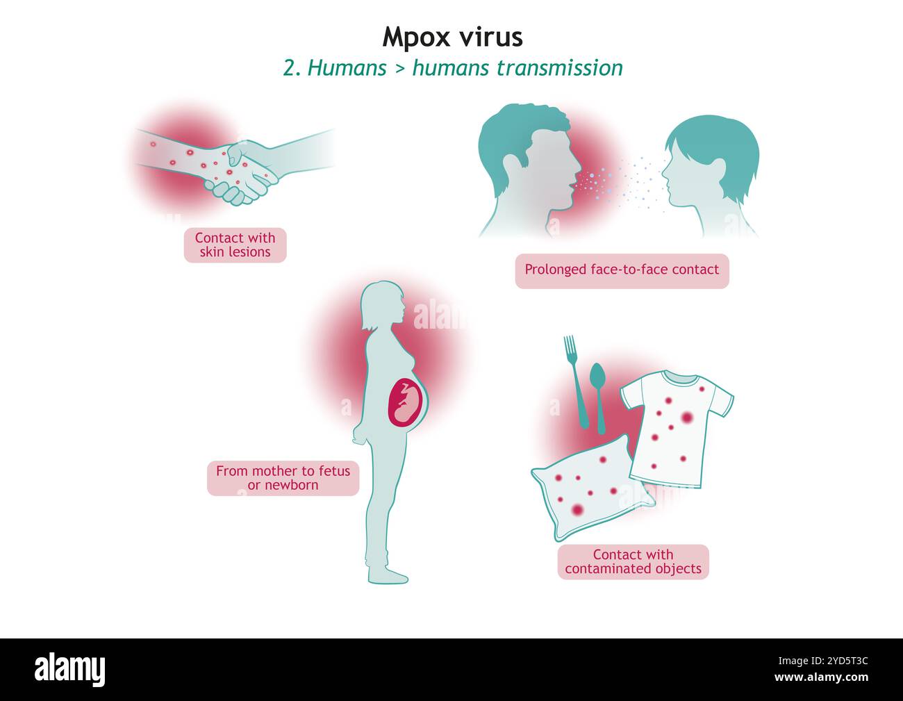 Human-to-human transmission of the Mpox virus Stock Photo - Alamy