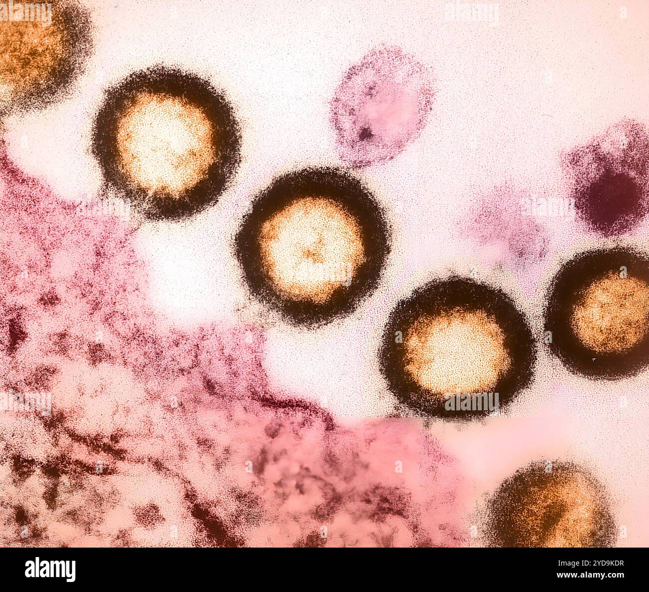 Transmission electron micrograph of HIV-1 virus particles gold ...