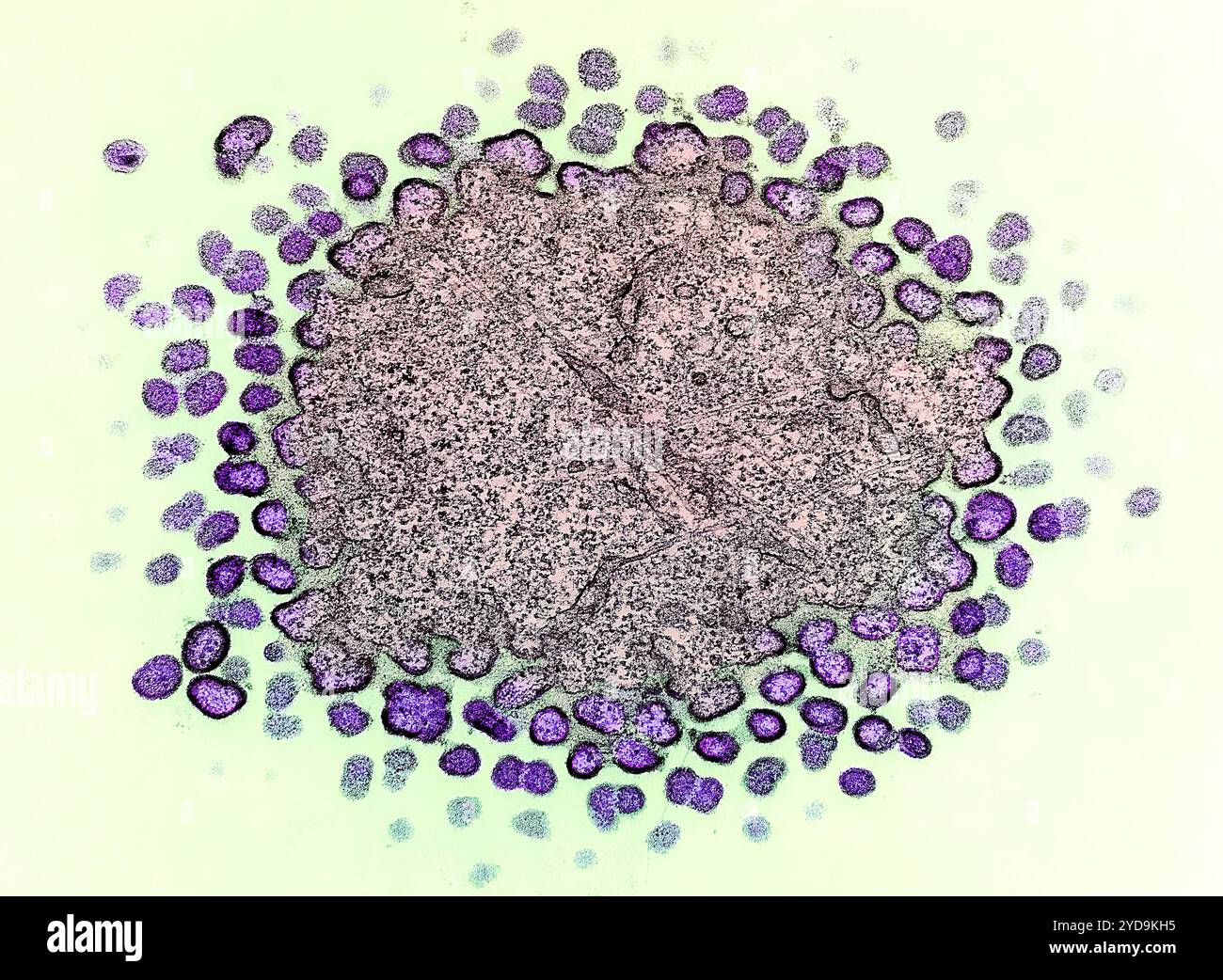 Colorized transmission electron micrograph of numerous HIV-1 virus ...