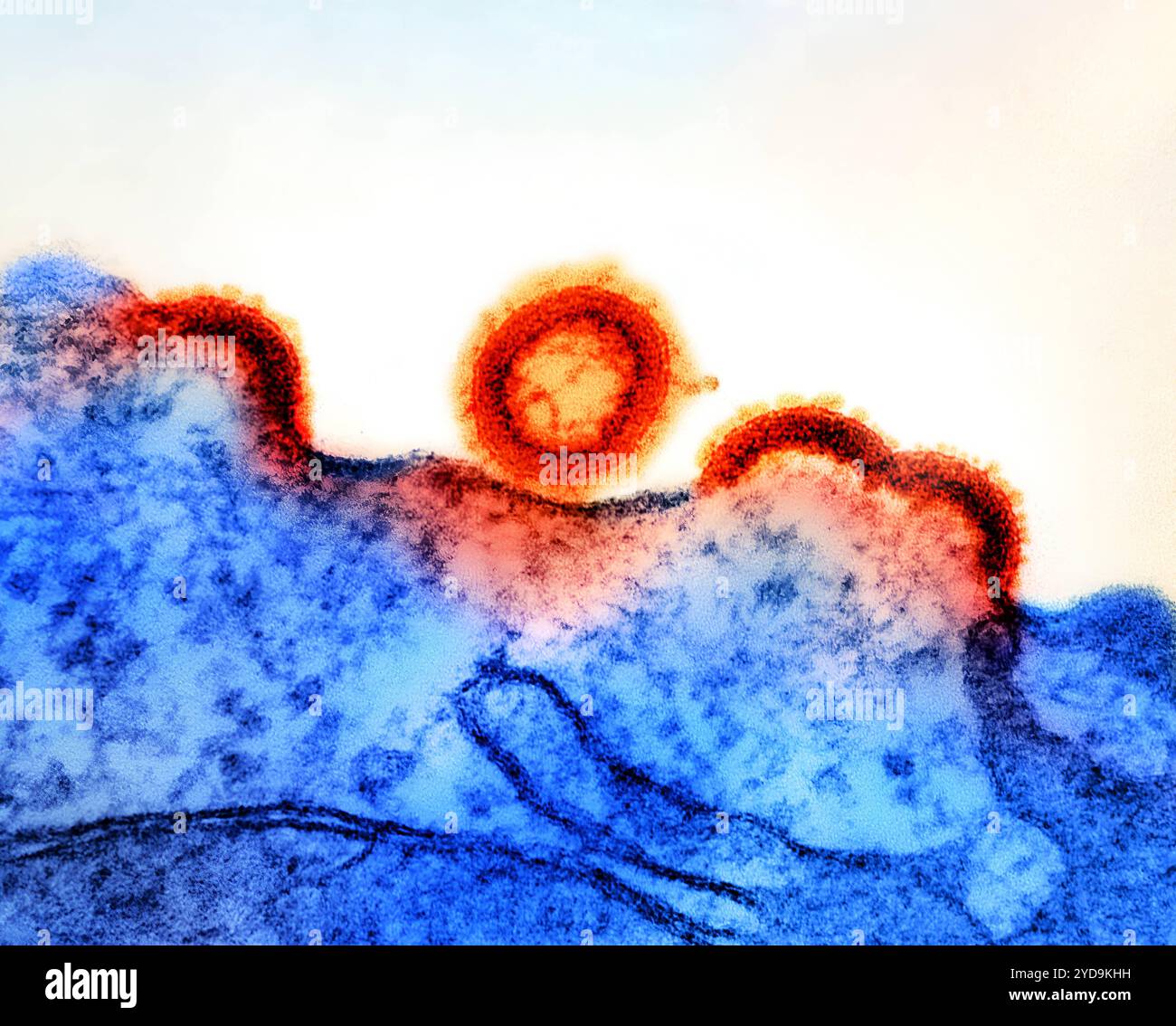 Transmission electron micrograph of HIV-1 virus particles colorized red/yellow replicating from ...