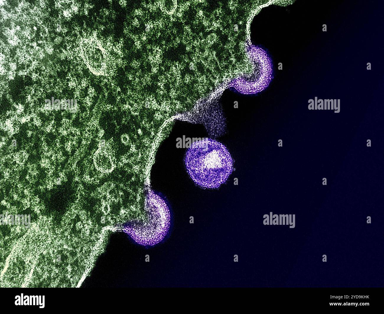 Transmission electron micrograph of HIV-1 virus particles purple from infected H9 cells ...