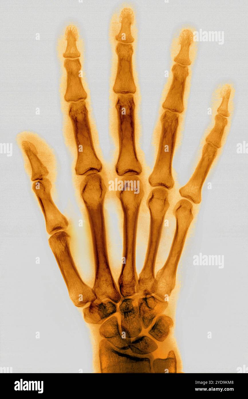 Normal wrist hi-res stock photography and images - Alamy