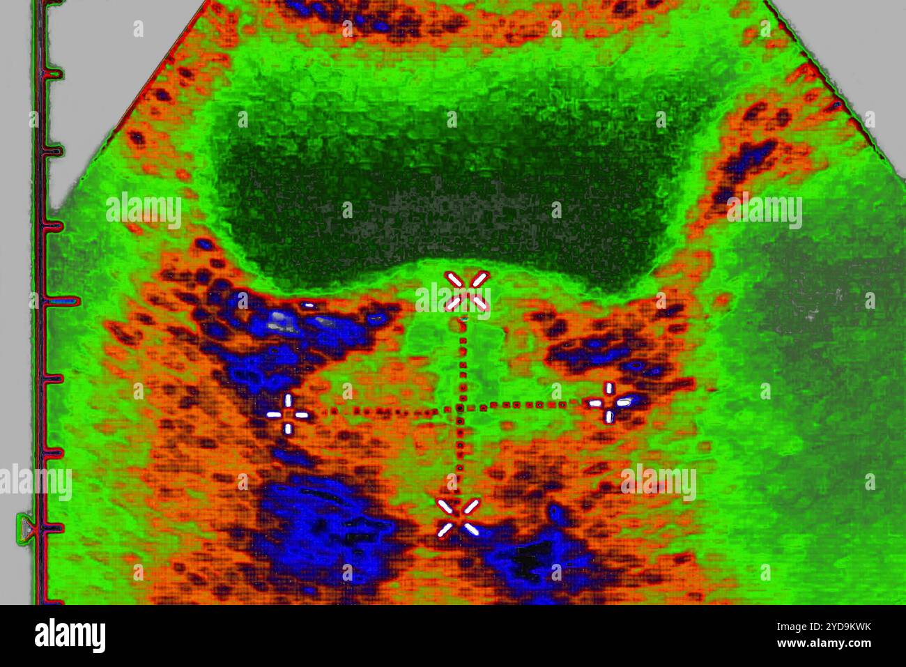 Prostate and bladder control examination with measurements of the ...