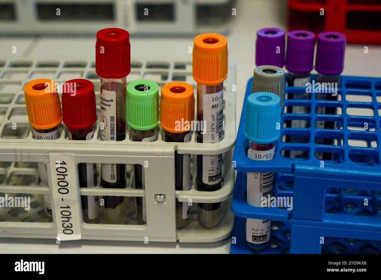 Medical analysis laboratory. Blood samples classified before analysis ...