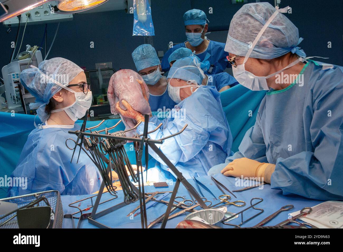 A surgical team performing acesarean section. cesarean section 016847 ...