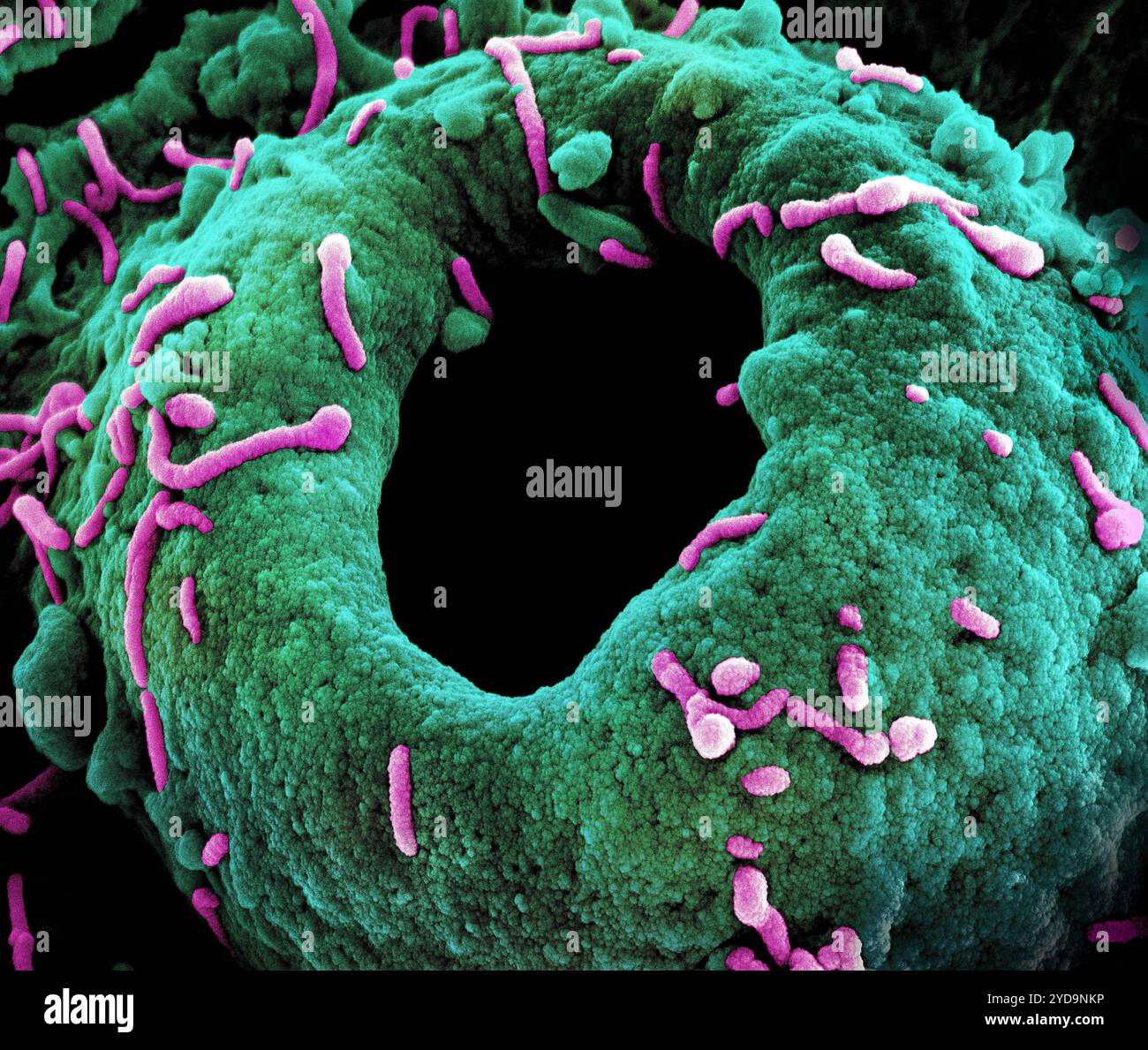 Colorized scanning electron micrograph of Marburg virus particles pink ...