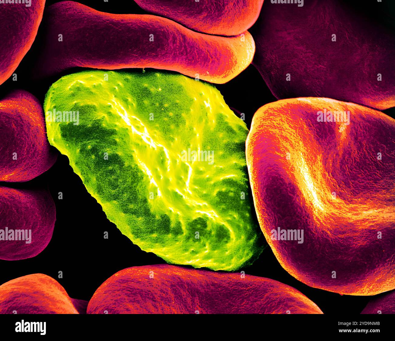 Colorized scanning electron micrograph of red blood cell infected with ...