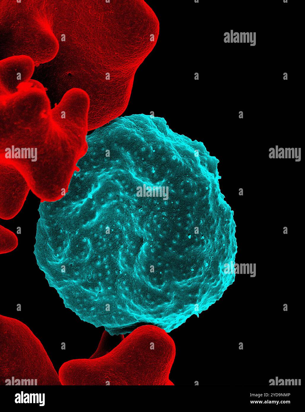 Colorized scanning electron micrograph of red blood cell infected with ...