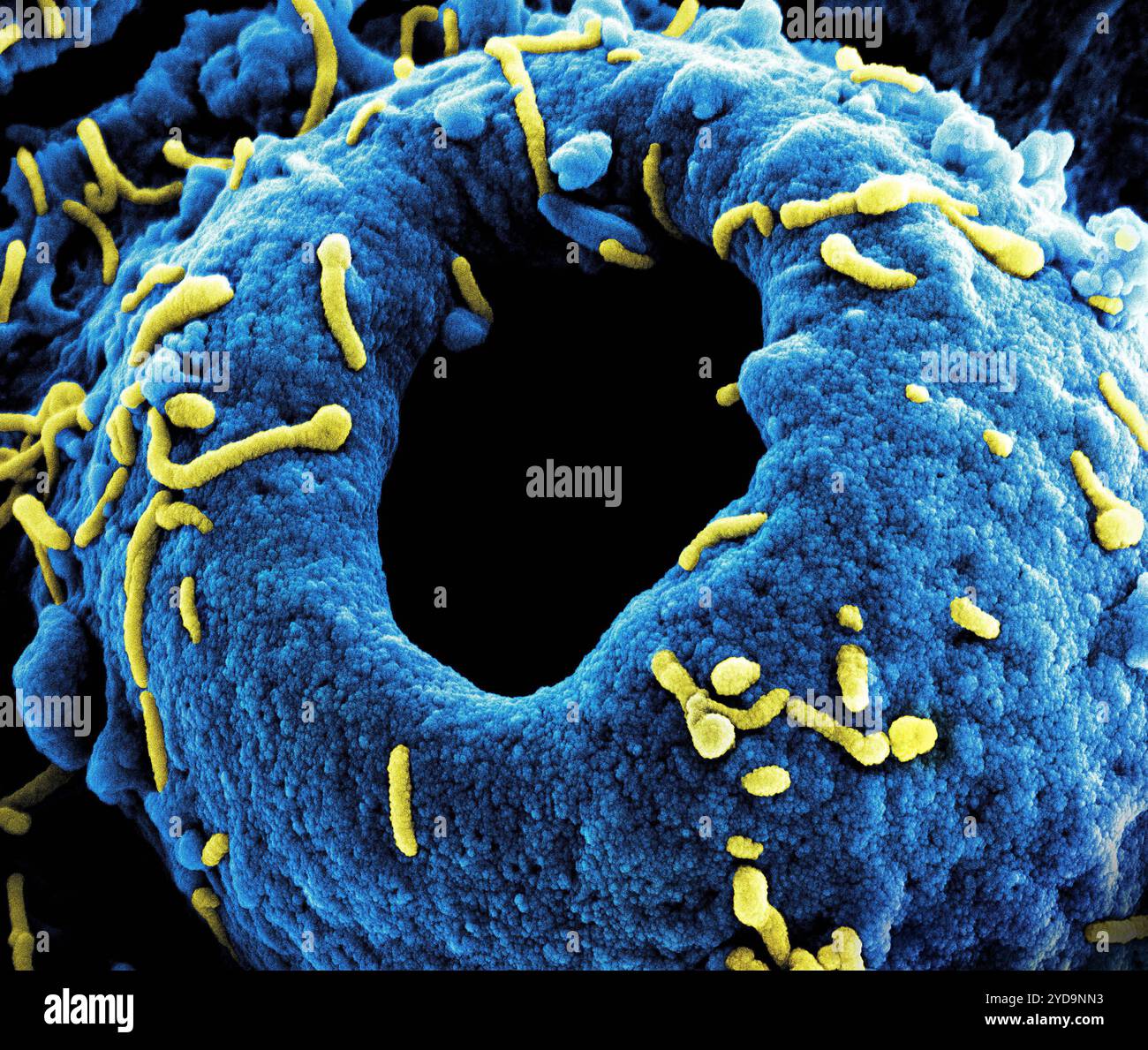 Colorized scanning electron micrograph of Marburg virus particles ...