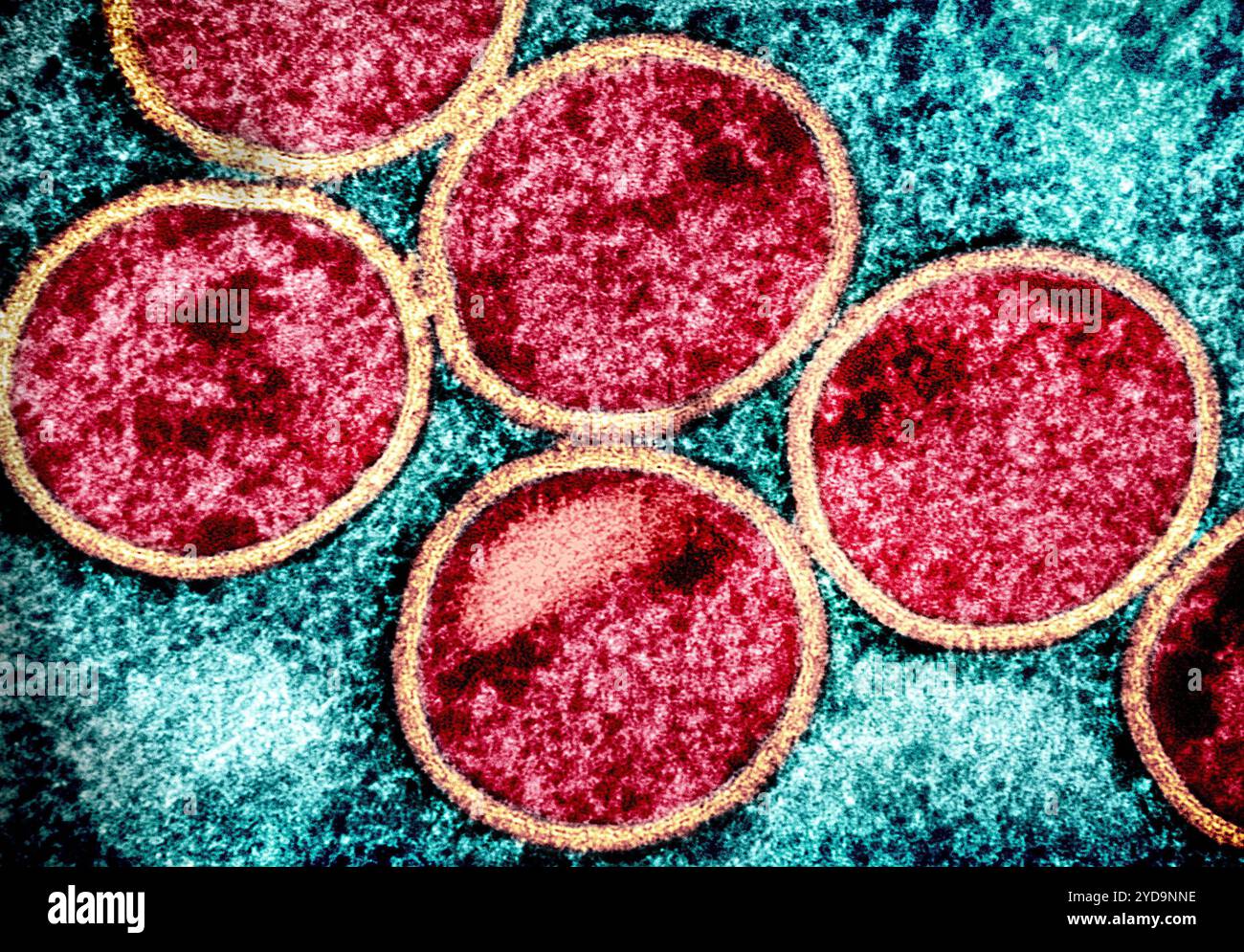Colorized transmission electron micrograph of immature mpox virus ...