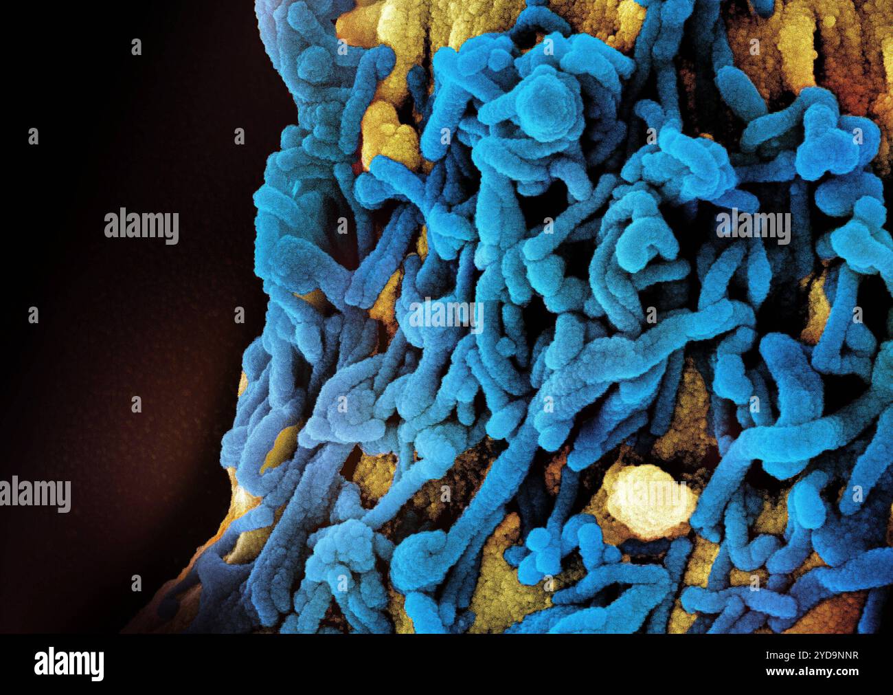 Colorized scanning electron micrograph of Marburg virus particles blue ...