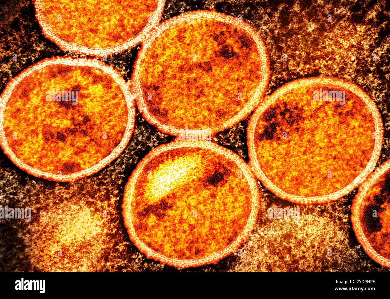 Colorized transmission electron micrograph of immature mpox virus ...