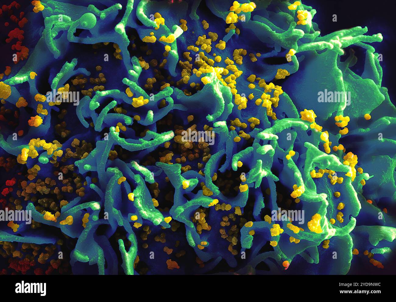 Scanning electron micrograph of a human H9 T cell blue/green infected ...