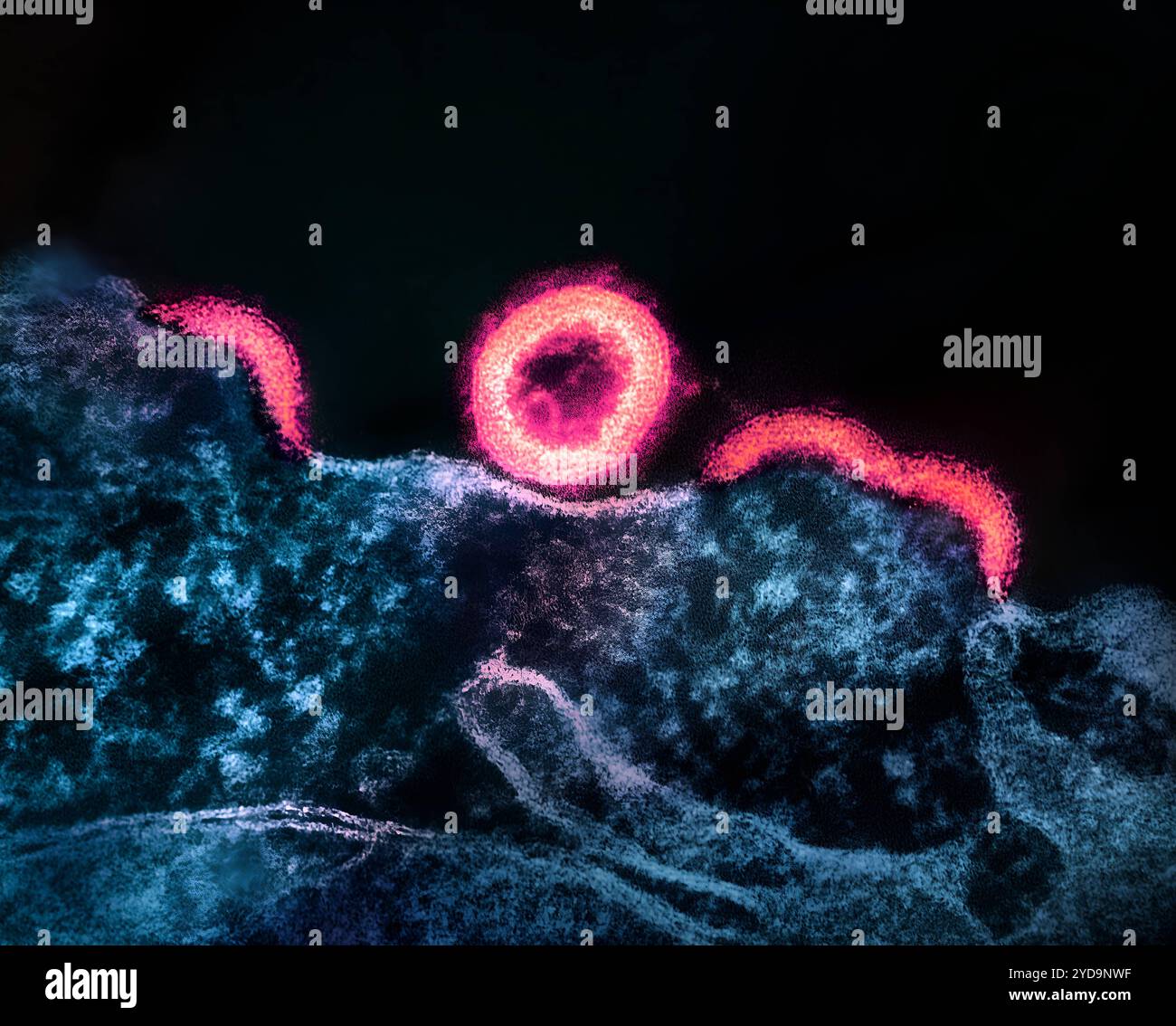 Transmission electron micrograph of HIV-1 virus particles colorized ...