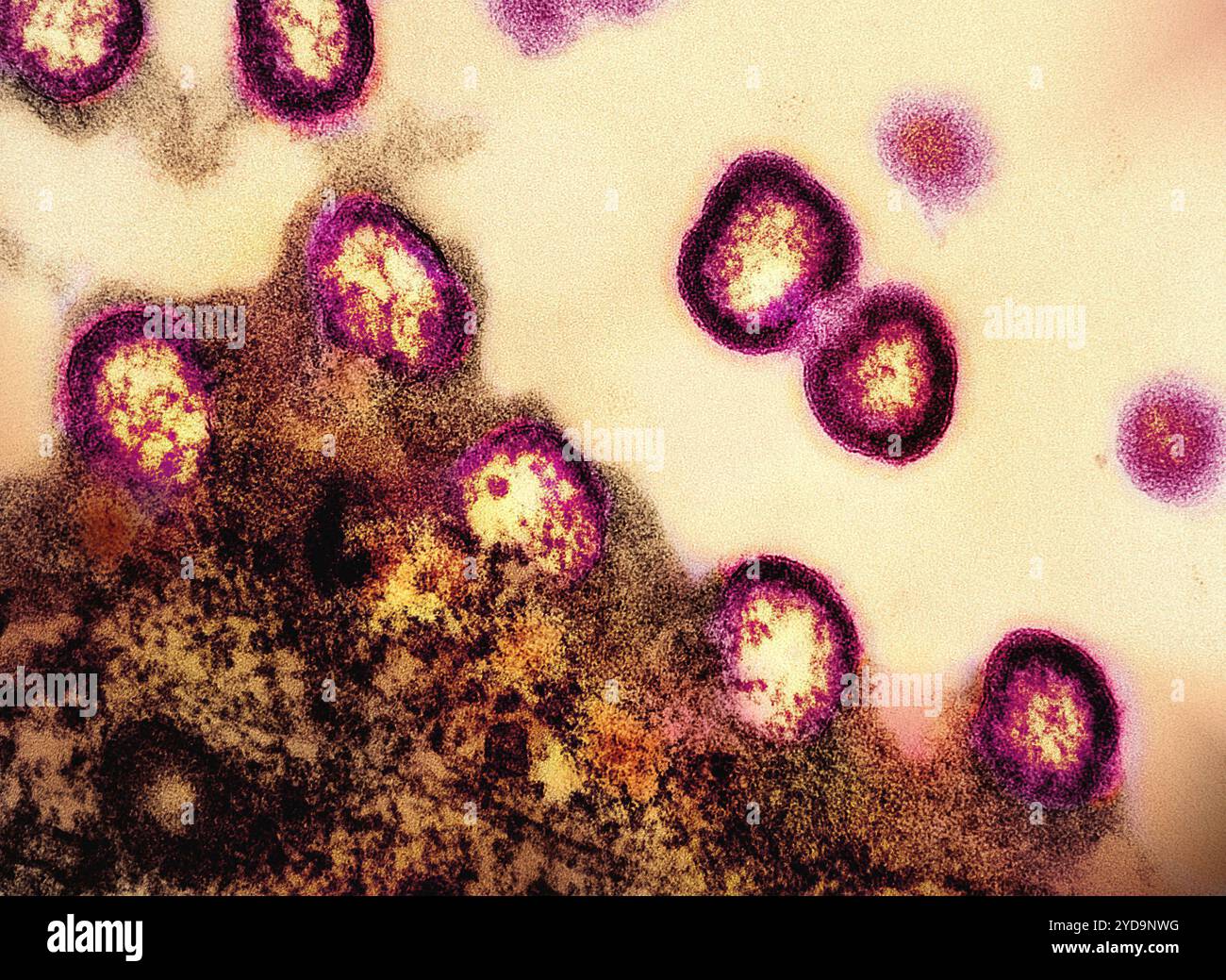 Transmission electron micrograph of HIV-1 virus particles colorized ...