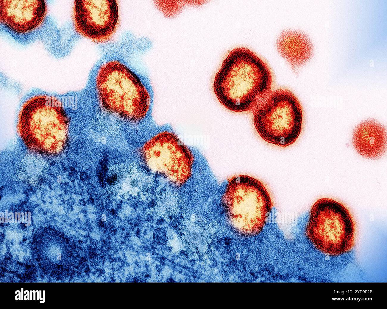 Transmission electron micrograph of HIV-1 virus particles colorized red ...