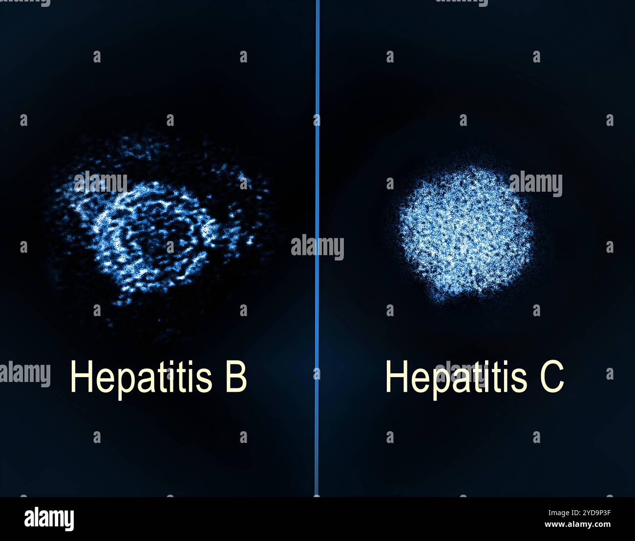 Side-by-side transmission electron micrograph images of hepatitis B and ...