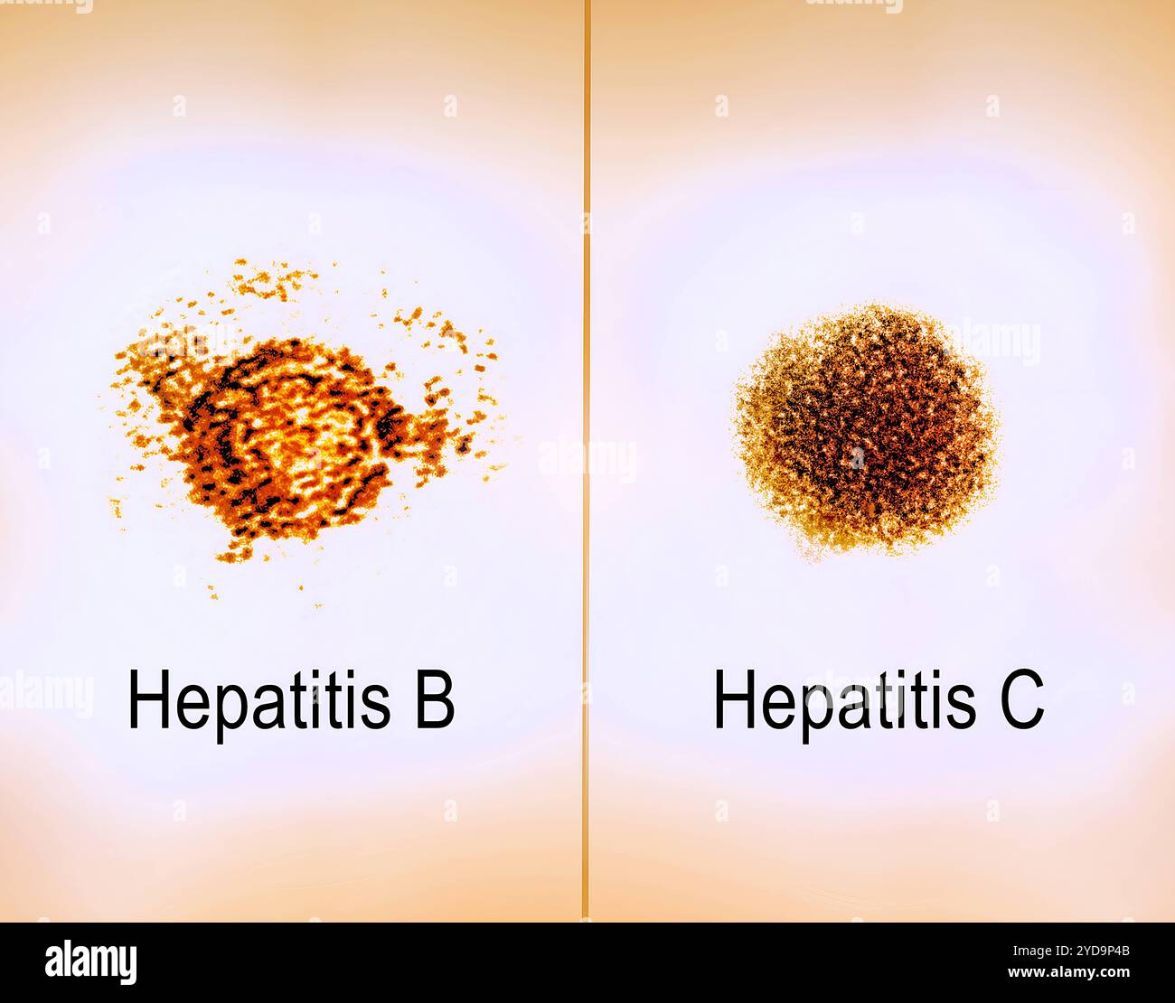 Side-by-side transmission electron micrograph images of hepatitis B and ...