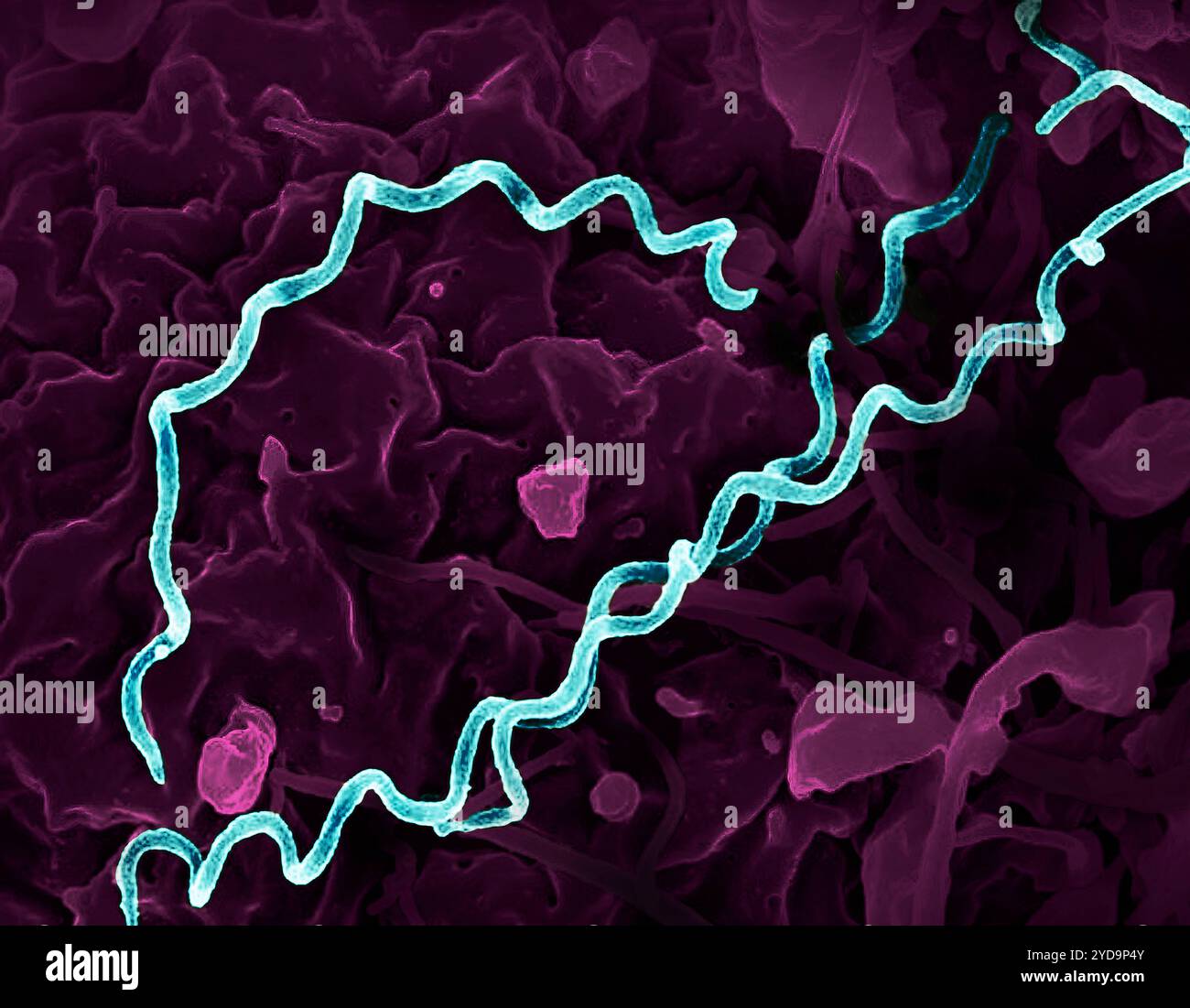 Colorized electron micrograph of Treponema pallidum, the bacteria that cause syphilis. Several ...